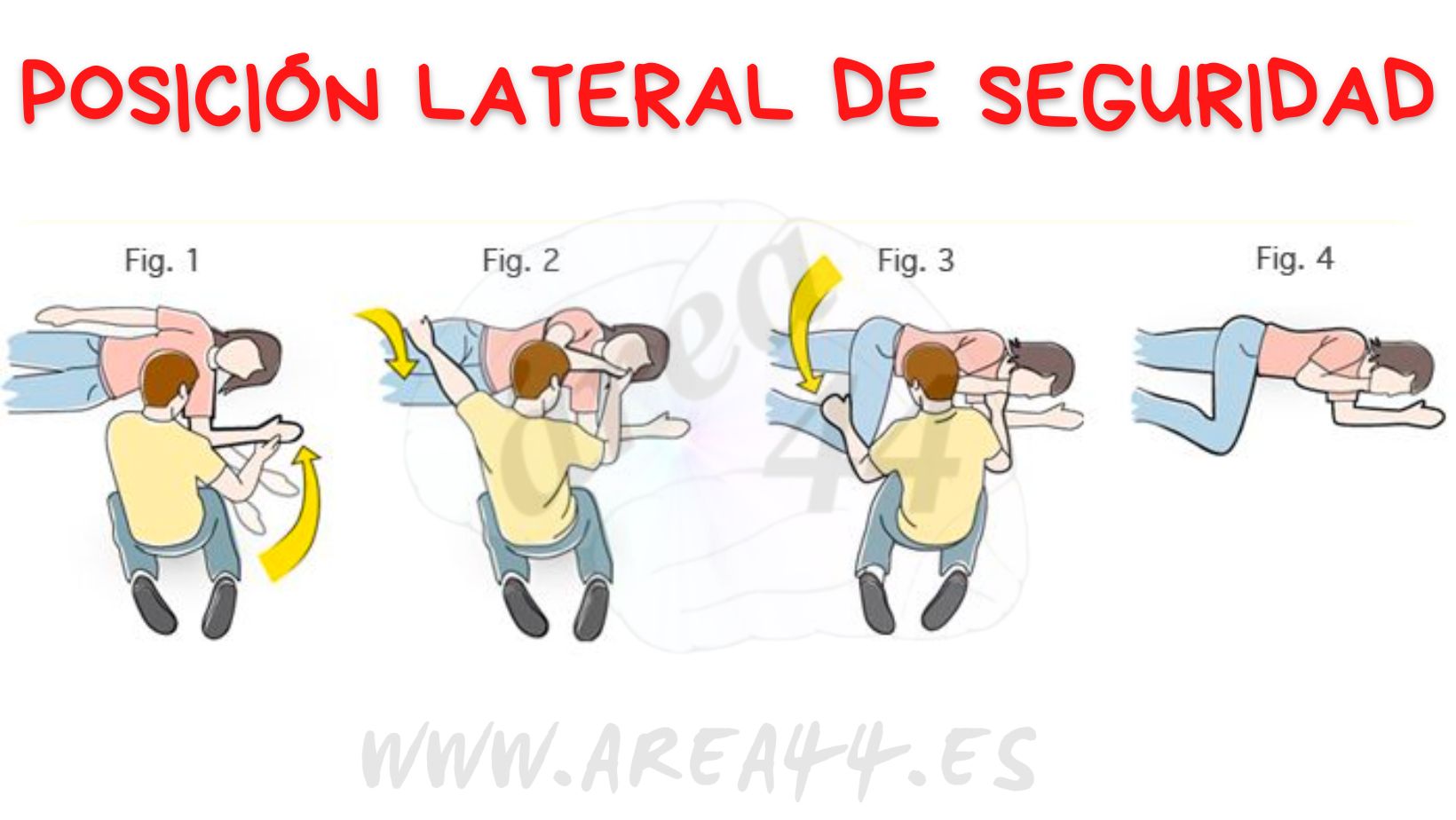 Posición Lateral De Seguridad en Niños (1) – -ÁREA 44- Centro ...